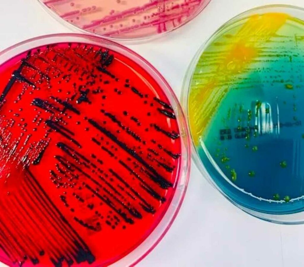 Bacteria: one discovery identified 35 strains of new species